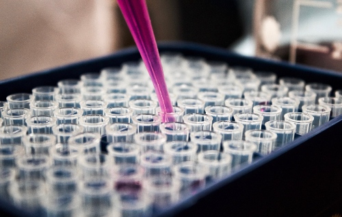 University impact award - University College Oxford (Univ)